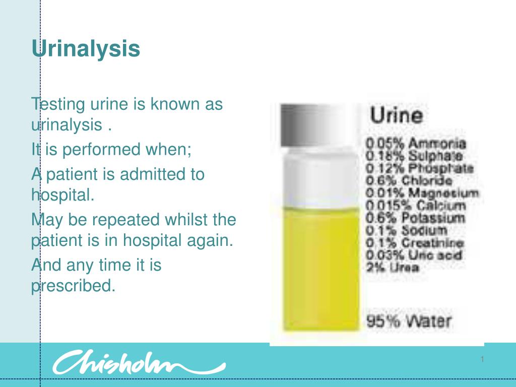 PPT - Urinalysis PowerPoint Presentation, free download - ID:2241001