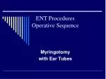 PPT - Myringotomy PowerPoint Presentation, free download - ID:3956149