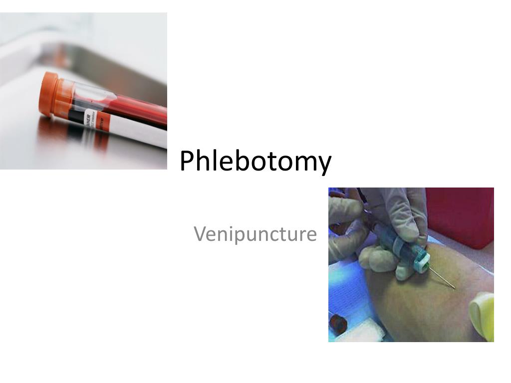 PPT - Phlebotomy PowerPoint Presentation, free download - ID:2247277