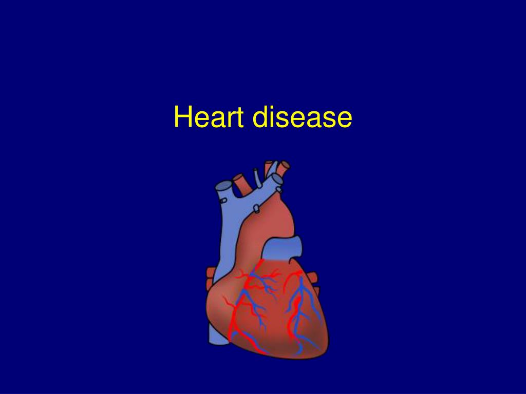 PPT - Heart disease PowerPoint Presentation, free download - ID:2249142