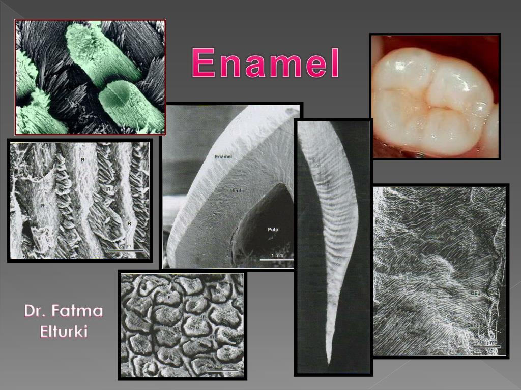 PPT - Enamel PowerPoint Presentation, free download - ID:2255941