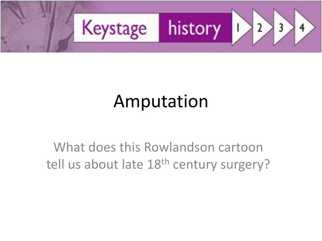 PPT - Amputation PowerPoint Presentation, free download - ID:2256891