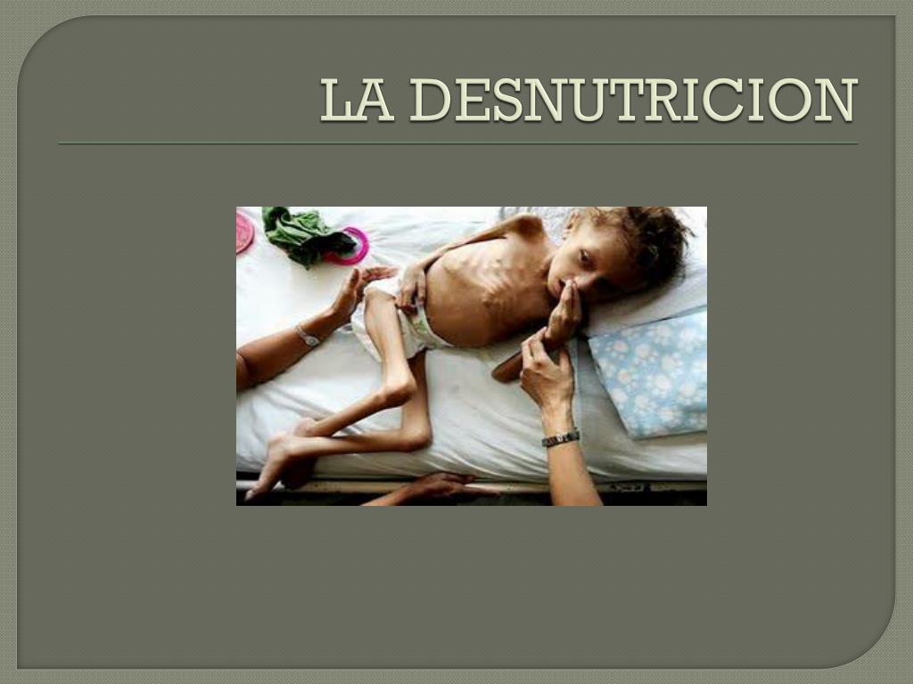 PPT - LA DESNUTRICION PowerPoint Presentation, free download - ID:2258789
