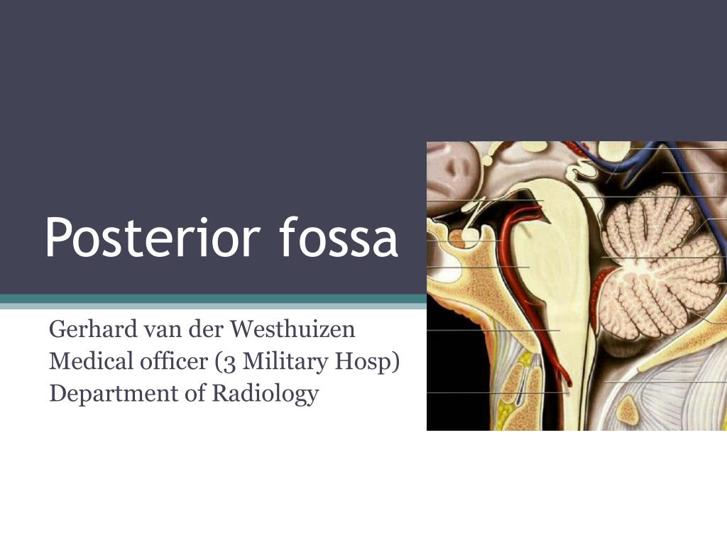 PPT - Posterior fossa PowerPoint Presentation, free download - ID:2264046