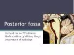 PPT - Setting Posterior Teeth PowerPoint Presentation, free download ...