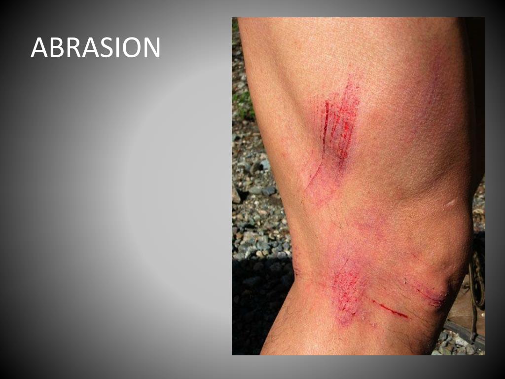 PPT - ABRASION PowerPoint Presentation, free download - ID:2264292