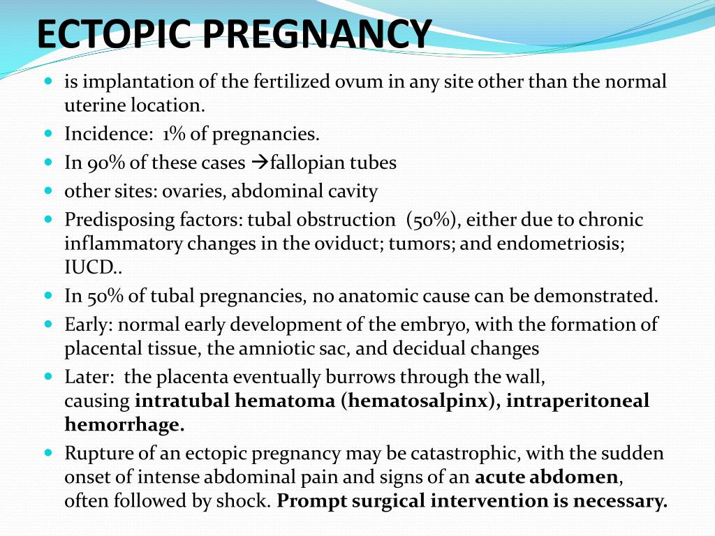 PPT - ECTOPIC PREGNANCY PowerPoint Presentation, free download - ID:2271577