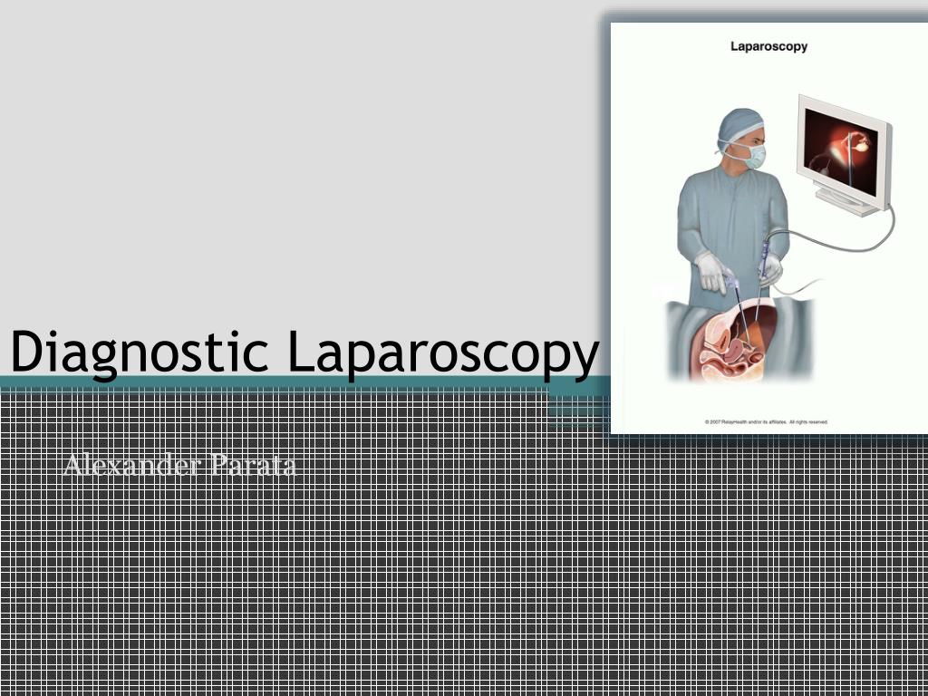 PPT - Diagnostic Laparoscopy PowerPoint Presentation, free download ...