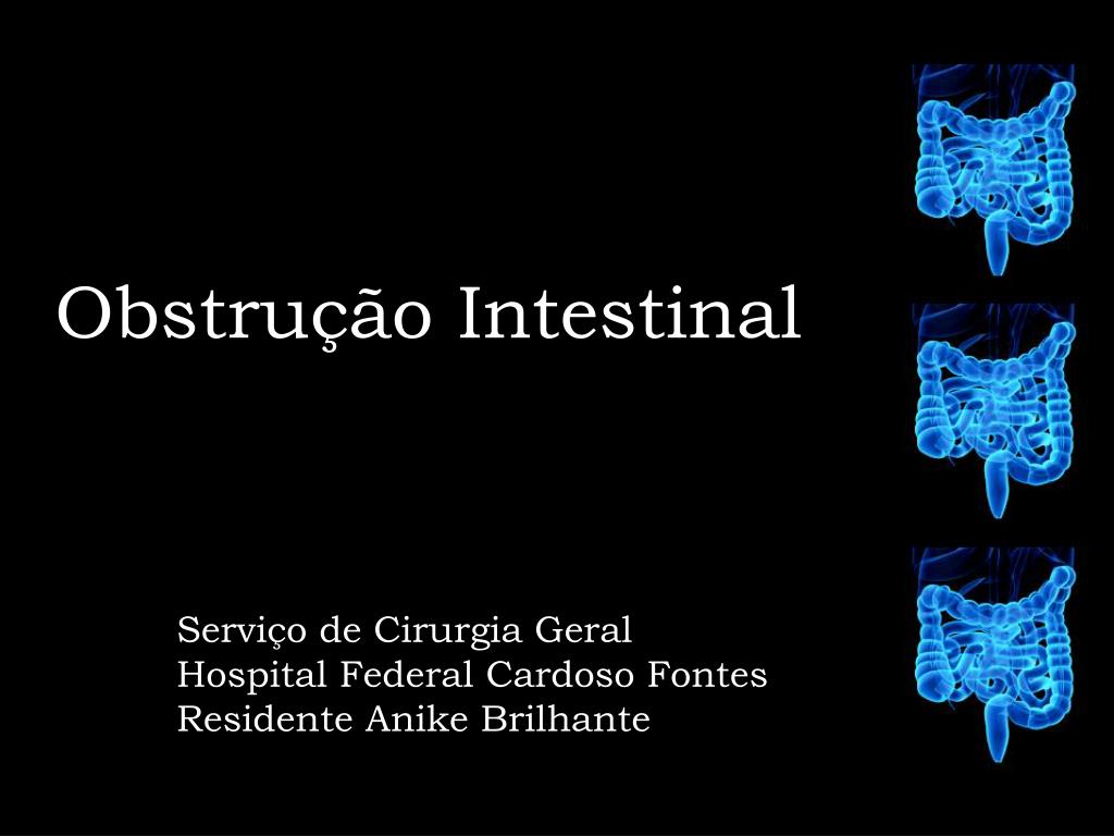 PPT - Obstrução Intestinal PowerPoint Presentation, free download - ID ...