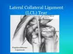 PPT - ACL (accurate ligament tear) PowerPoint Presentation, free ...
