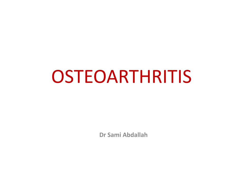 PPT - OSTEOARTHRITIS PowerPoint Presentation, free download - ID:2293987