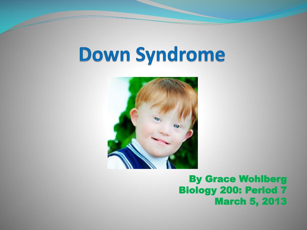 PPT - Down Syndrome PowerPoint Presentation, free download - ID:2307614