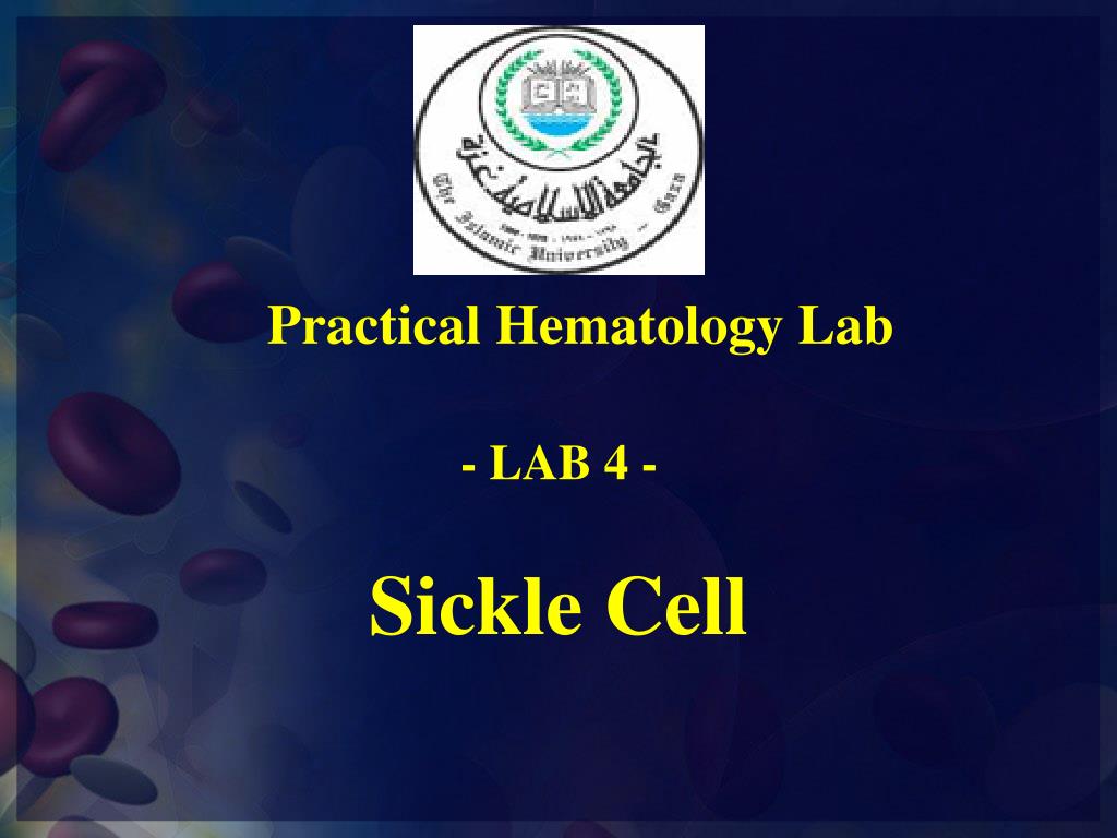 PPT - Sickle Cell PowerPoint Presentation, free download - ID:2347744