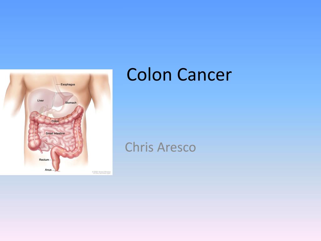 PPT - Colon Cancer PowerPoint Presentation, free download - ID:2360697