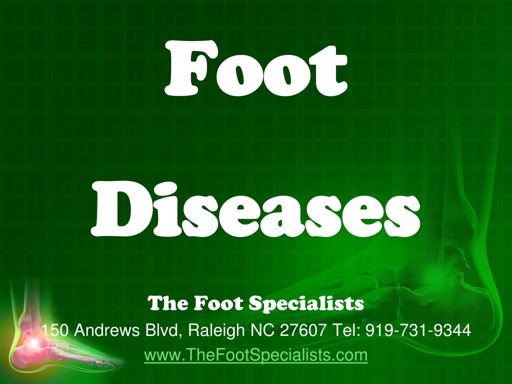 PPT - Foot Diseases PowerPoint Presentation, free download - ID:2362938