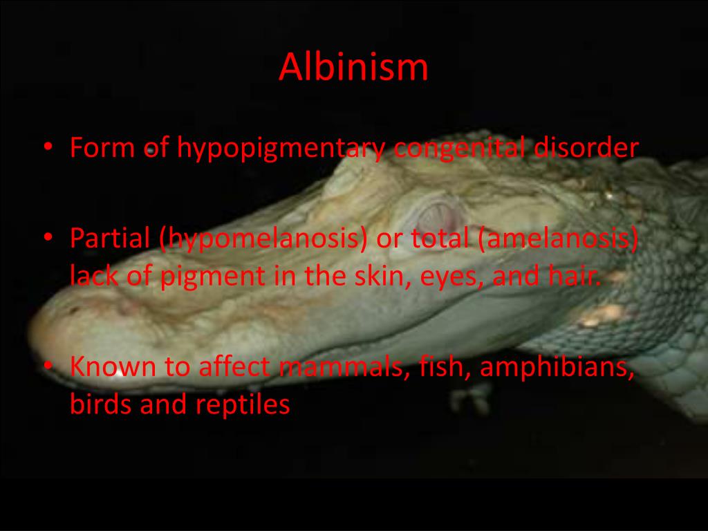 PPT - Albinism PowerPoint Presentation, free download - ID:2370965