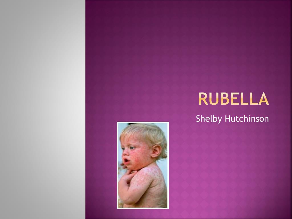 PPT - Rubella PowerPoint Presentation, free download - ID:2382467