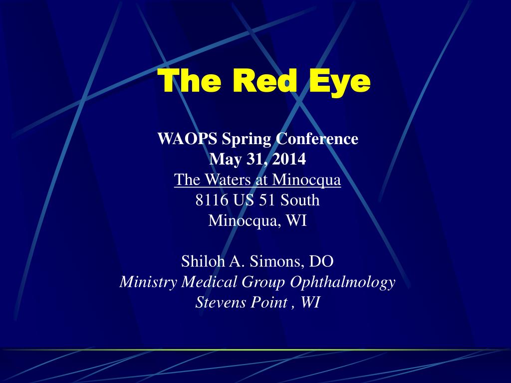 PPT - The Red Eye PowerPoint Presentation, free download - ID:2392211