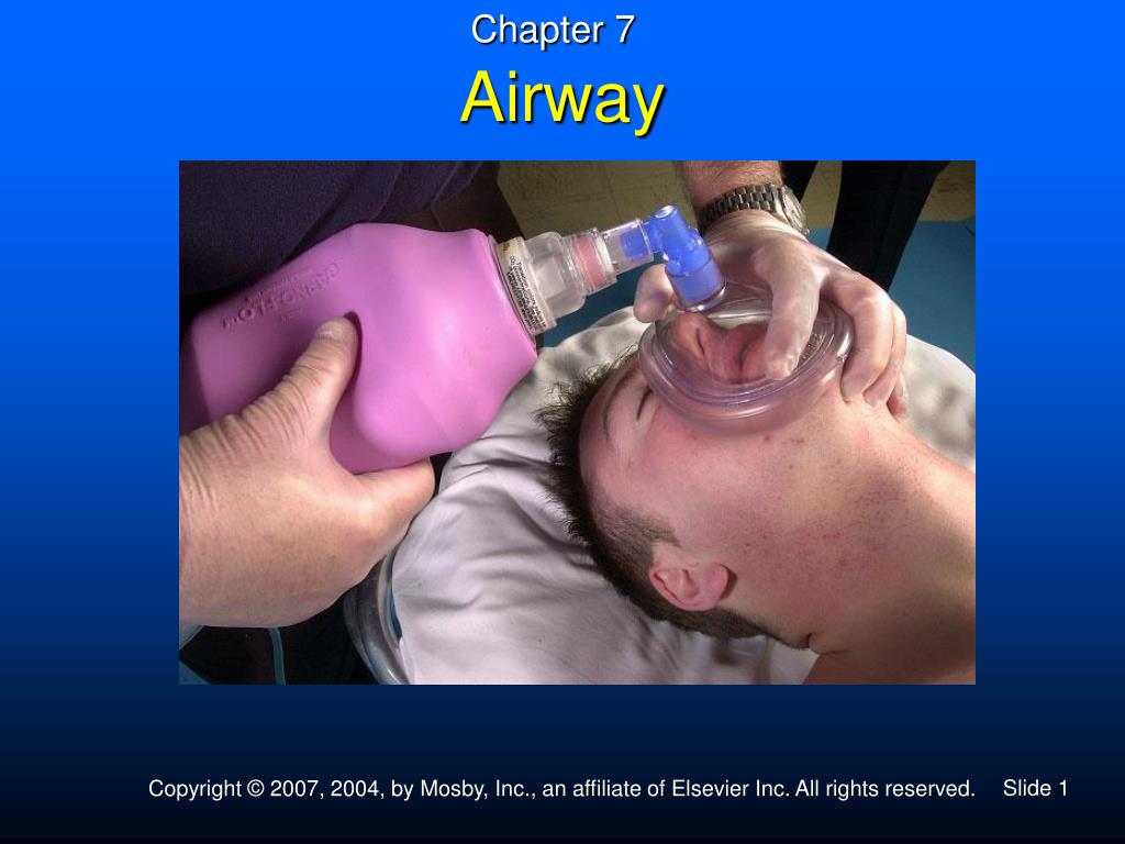 PPT - Airway PowerPoint Presentation, free download - ID:2411098