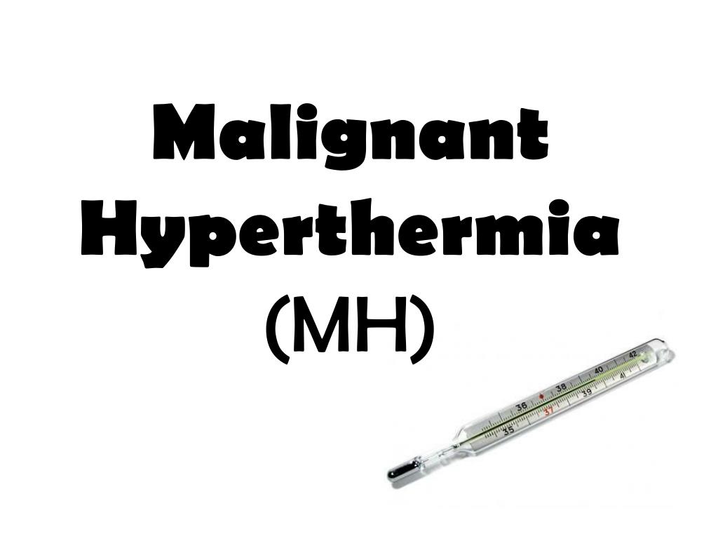 PPT - Malignant Hyperthermia (MH) PowerPoint Presentation, free ...