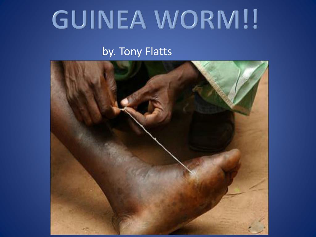 PPT - guinea worm!! PowerPoint Presentation, free download - ID:2444675