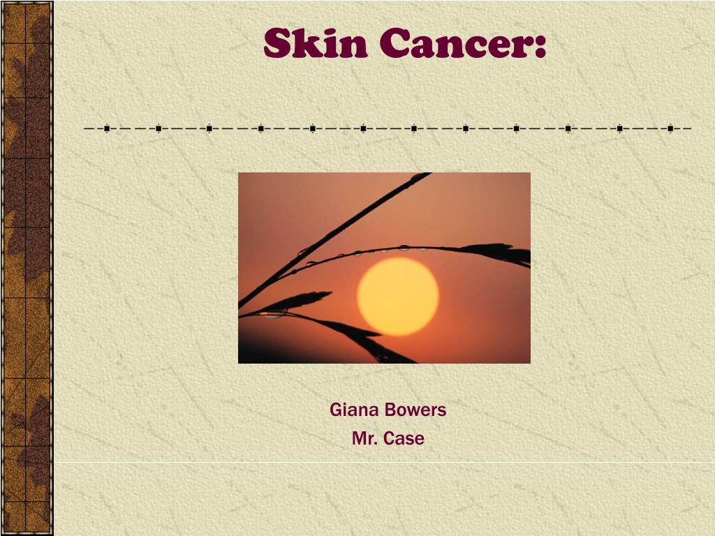 PPT - Skin Cancer: PowerPoint Presentation, free download - ID:2532210