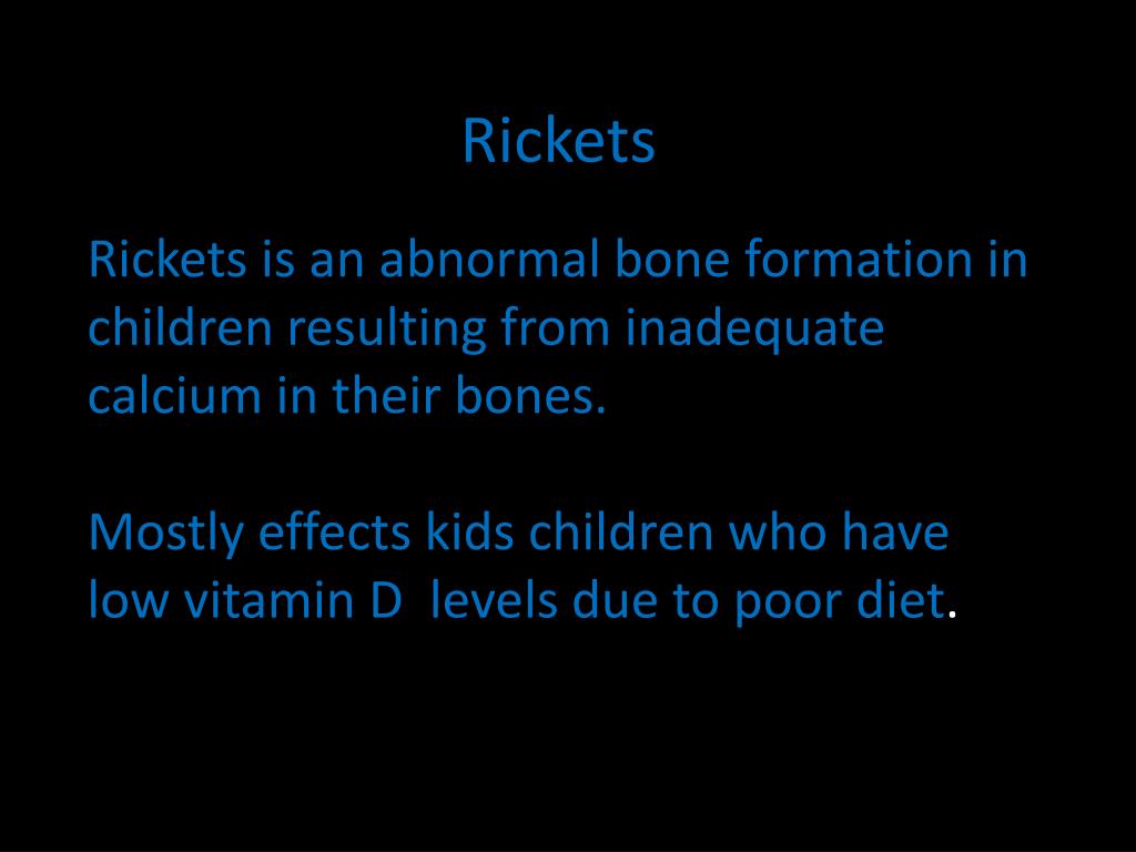 PPT - Rickets PowerPoint Presentation, free download - ID:2568453