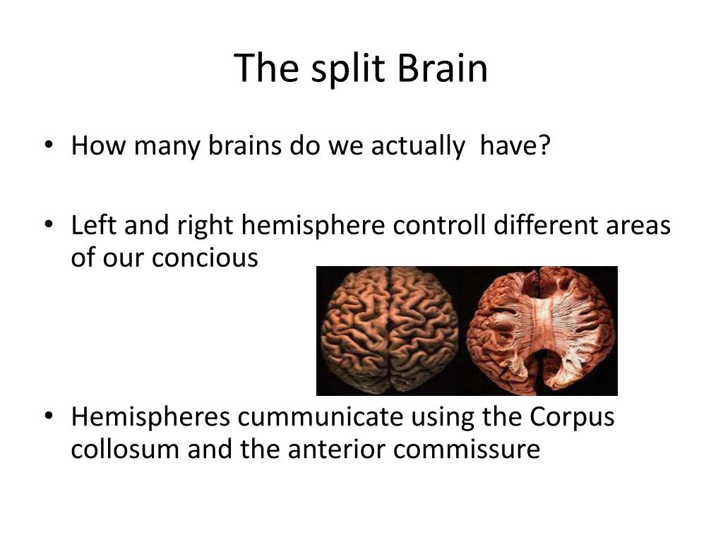 PPT - The split Brain PowerPoint Presentation, free download - ID:2591366