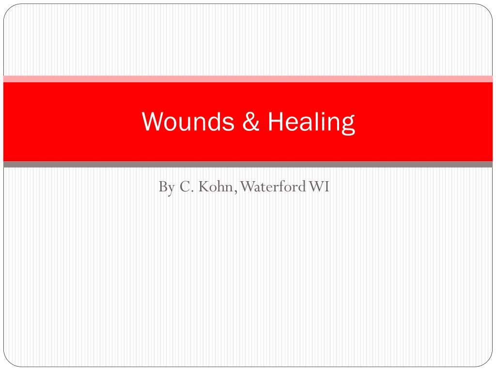PPT - Wounds & Healing PowerPoint Presentation, free download - ID:2612806