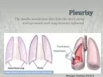 PPT - Pleurisy PowerPoint Presentation, free download - ID:1047910