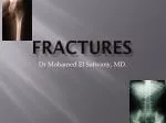 PPT - Midface Fractures PowerPoint Presentation, free download - ID:6370554