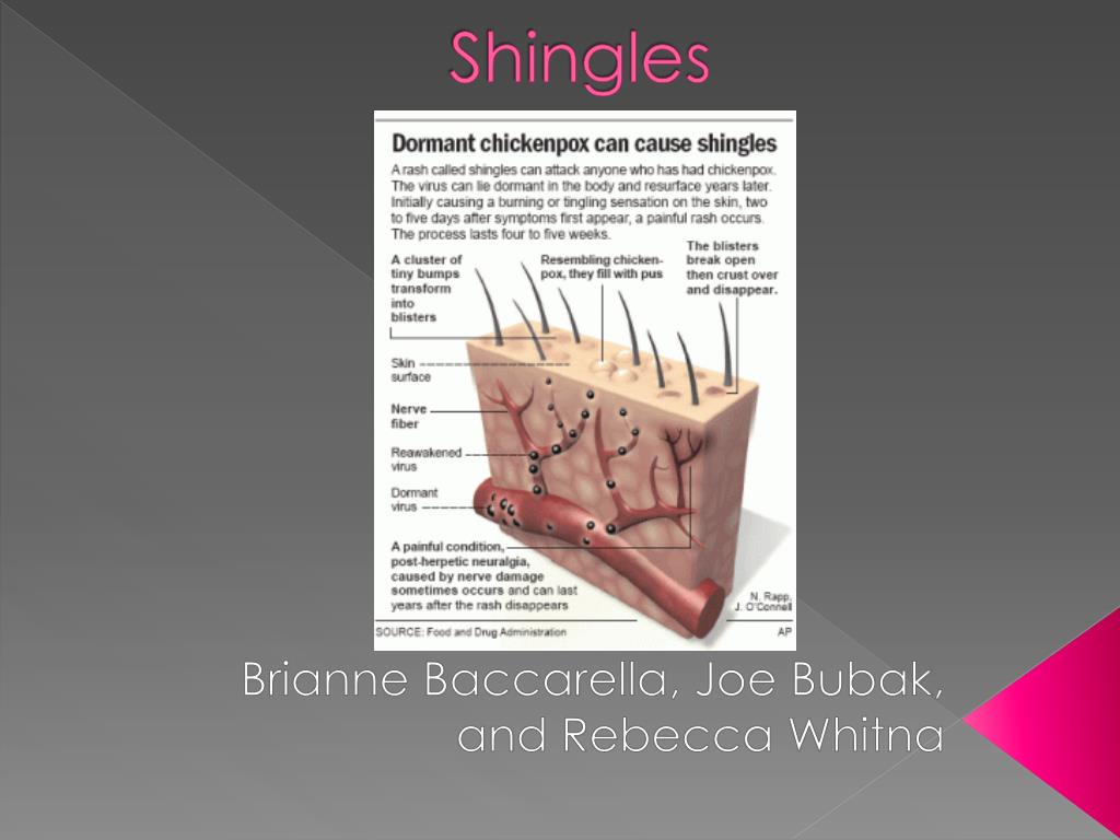 PPT - Shingles PowerPoint Presentation, free download - ID:2643397