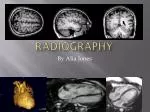 PPT - Computed Radiography PowerPoint Presentation, free download - ID ...