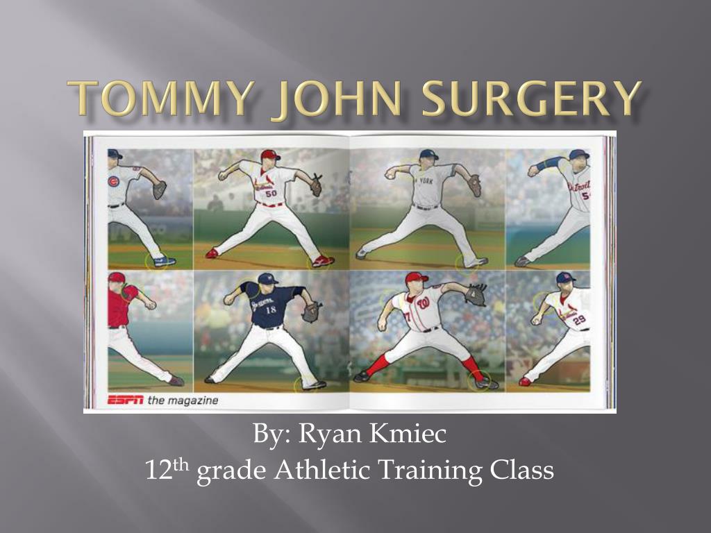 PPT - Tommy john surgery PowerPoint Presentation, free download - ID ...