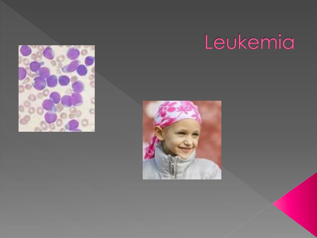PPT - Leukemia PowerPoint Presentation, free download - ID:2711274