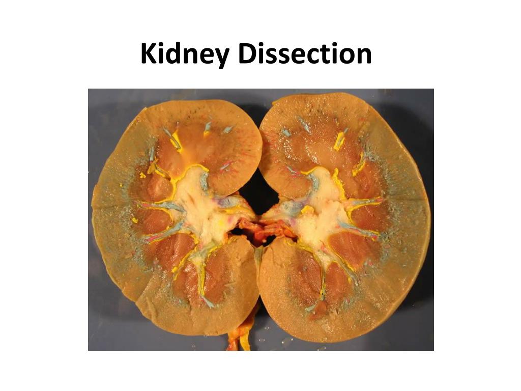 PPT - Kidney Dissection PowerPoint Presentation, free download - ID:2721551