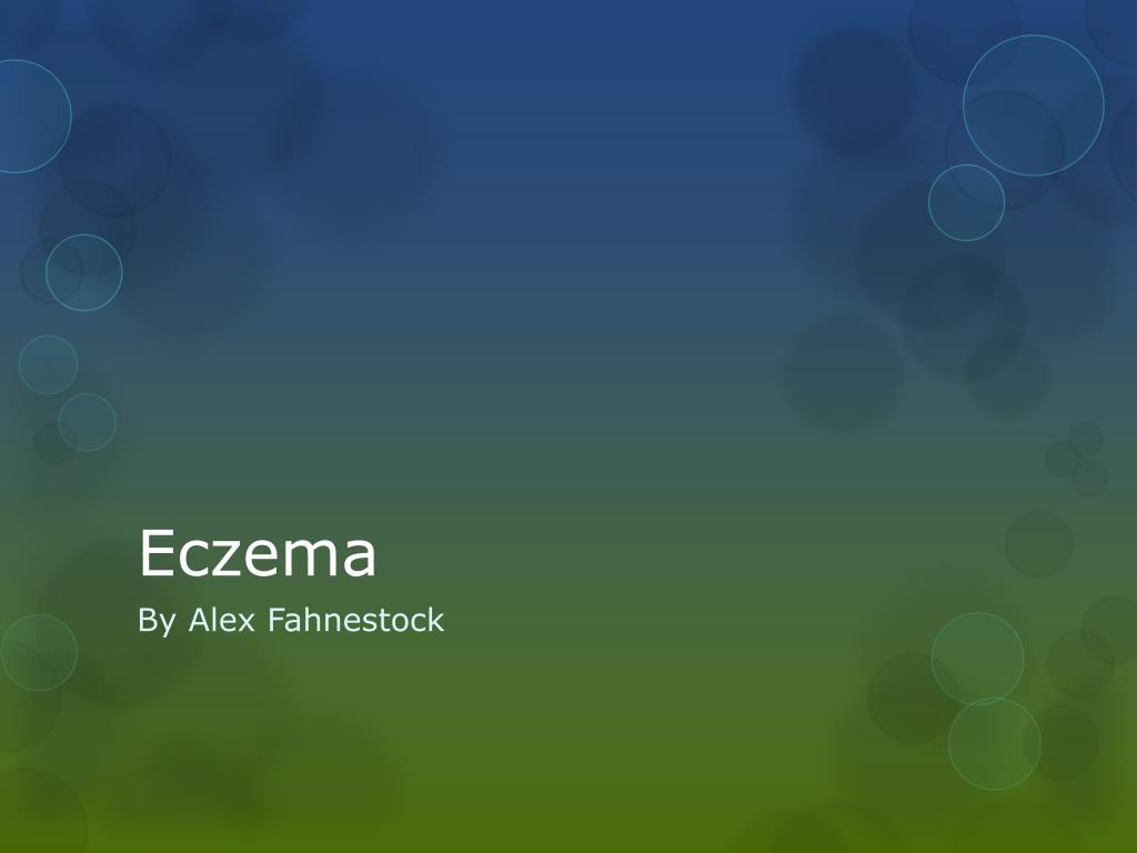 PPT - Eczema PowerPoint Presentation, free download - ID:2731313