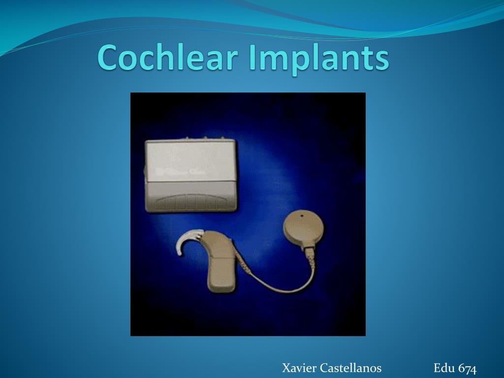 PPT - Cochlear Implants PowerPoint Presentation, free download - ID:2753101