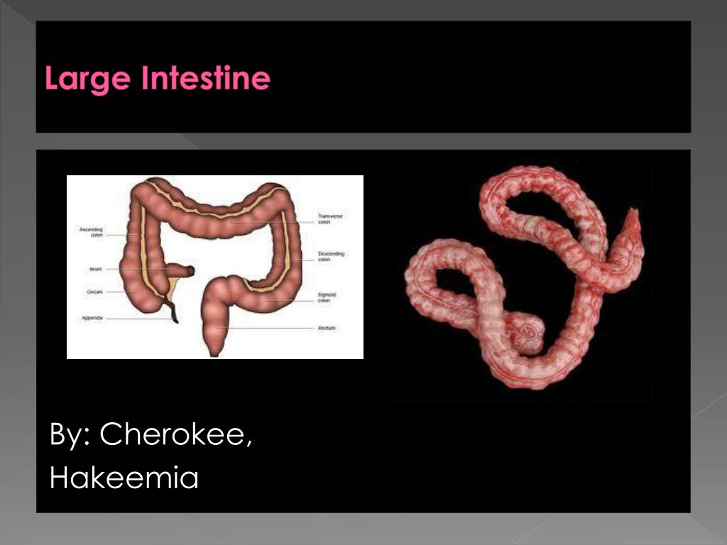 PPT - Large Intestine PowerPoint Presentation, free download - ID:2788955