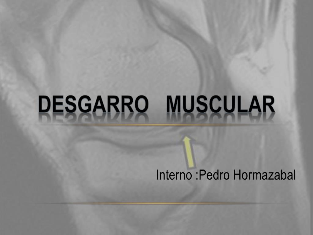 PPT - Desgarro muscular PowerPoint Presentation, free download - ID:2796553