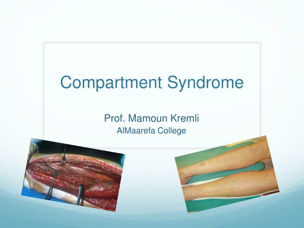 PPT - Compartment Syndrome PowerPoint Presentation, free download - ID ...