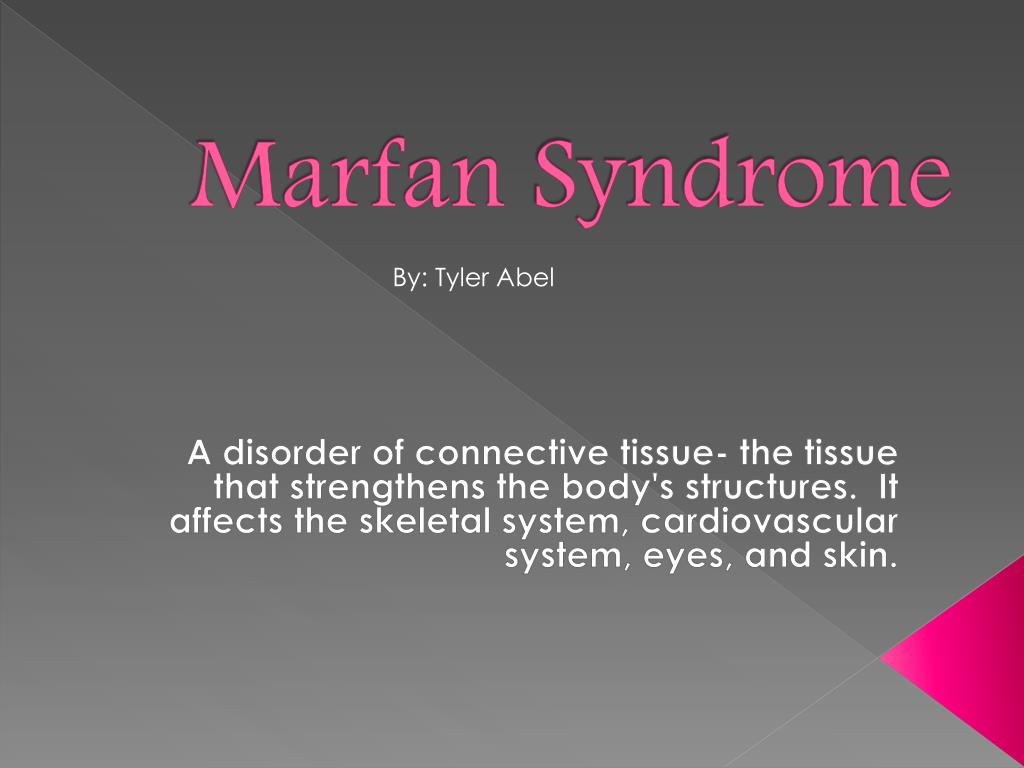 PPT - Marfan Syndrome PowerPoint Presentation, free download - ID:2823317