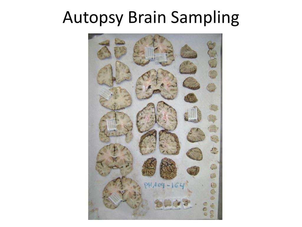 PPT - Autopsy Brain Sampling PowerPoint Presentation, free download ...