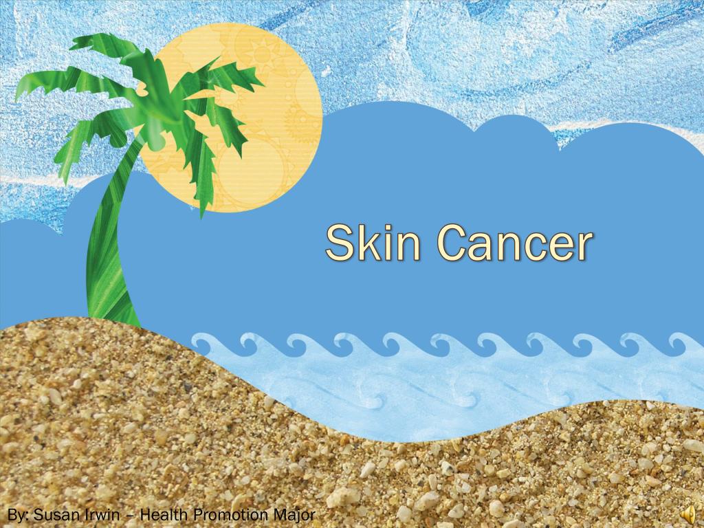 PPT - Skin Cancer PowerPoint Presentation, free download - ID:2849715