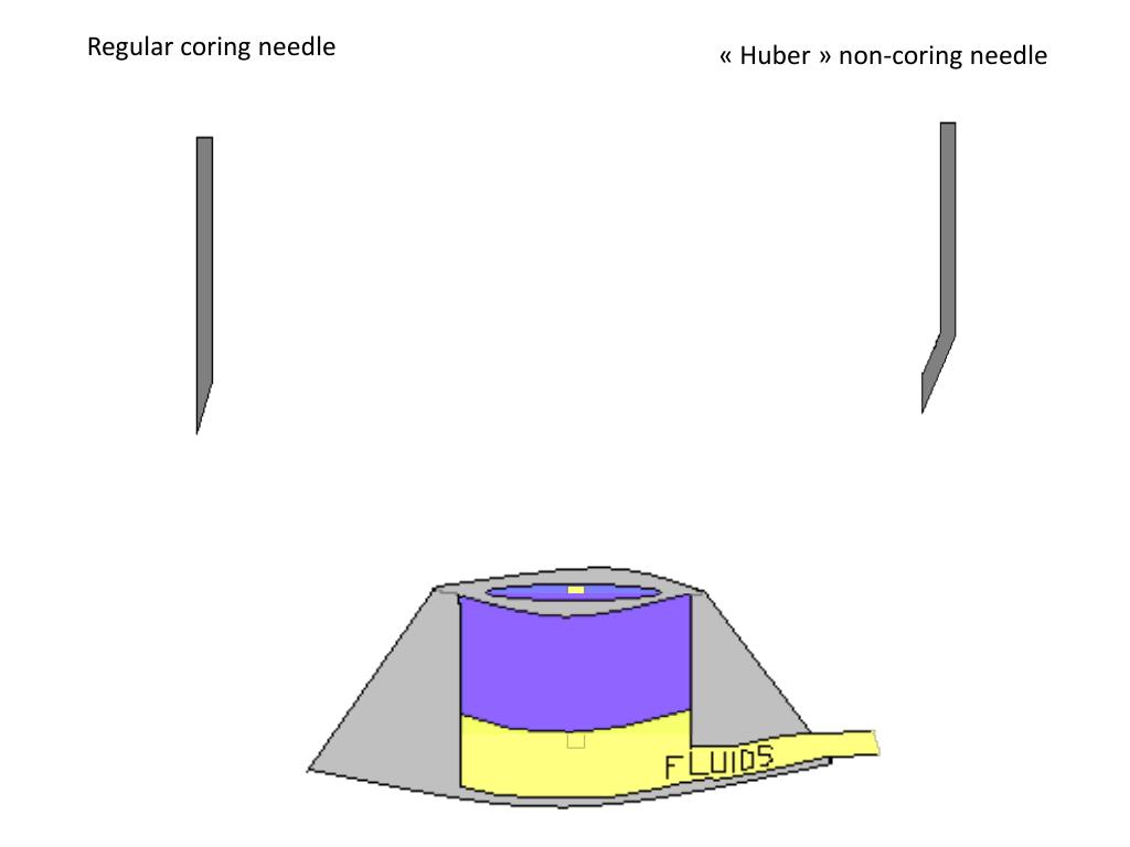 PPT - Regular coring needle PowerPoint Presentation, free download - ID ...