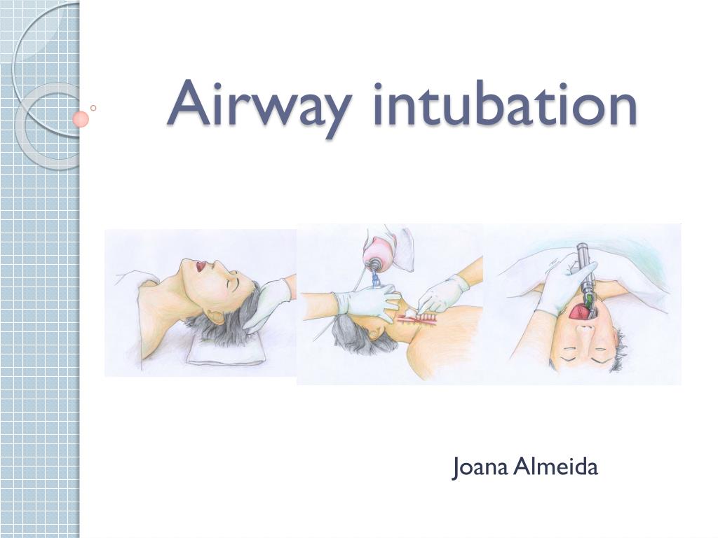 PPT - Airway intubation PowerPoint Presentation, free download - ID:2894259