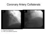 PPT - TIMI GRADING OF FLOW THROMBUS COLLATERALS SCAD DISSECTION ...
