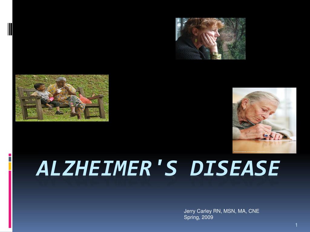 PPT - Alzheimer's Disease PowerPoint Presentation, free download - ID ...