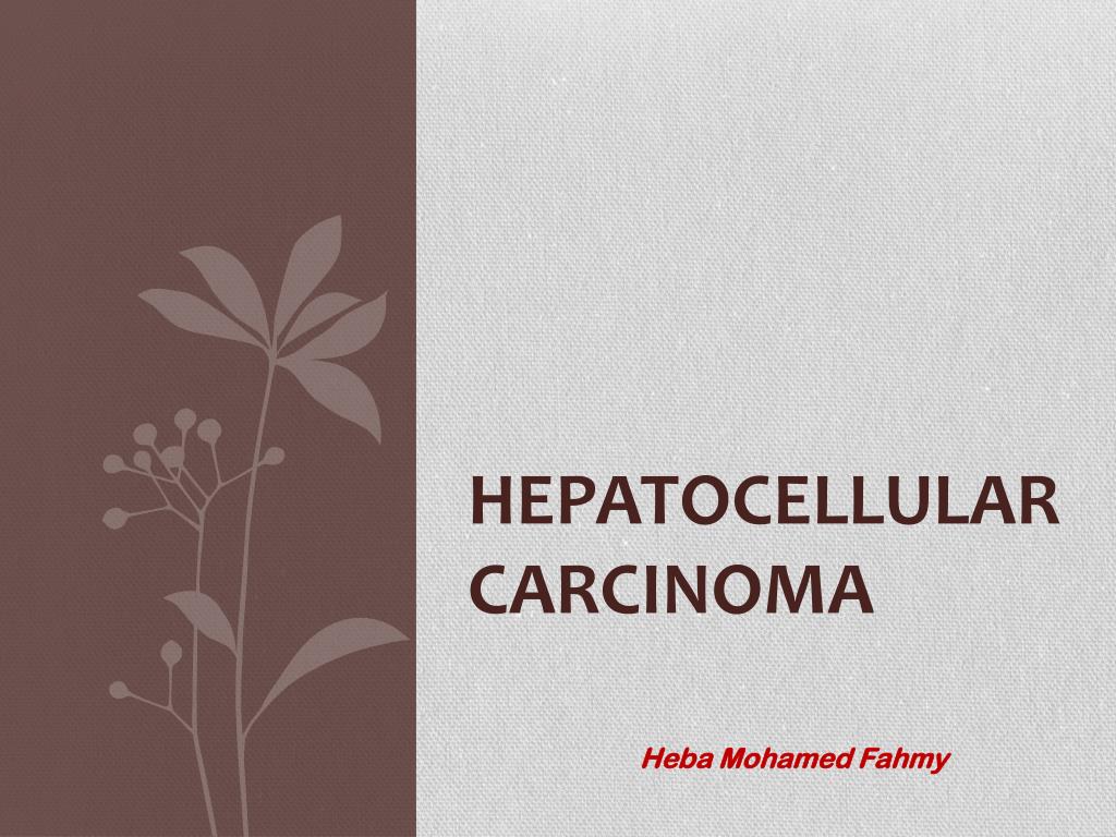 PPT - Hepatocellular Carcinoma PowerPoint Presentation, free download ...