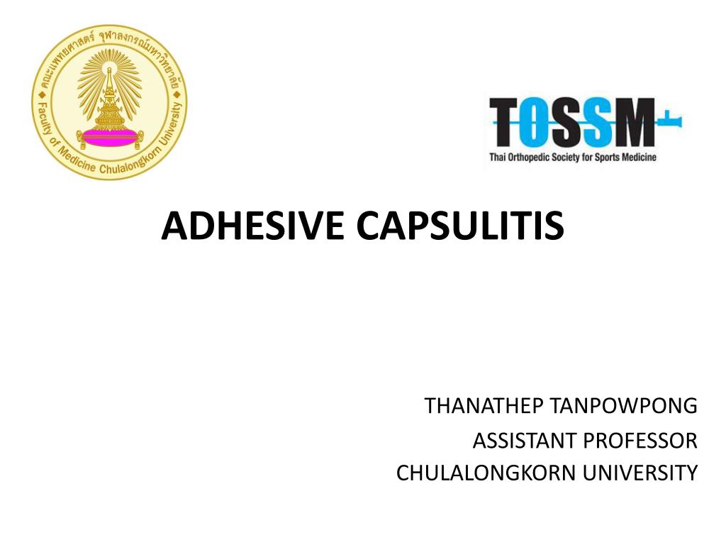 PPT - ADHESIVE CAPSULITIS PowerPoint Presentation, free download - ID ...